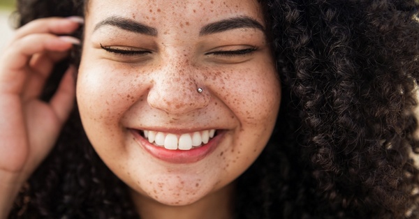 Find All The Different Freckles - Dailybreak