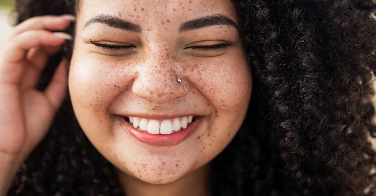 Find All The Different Freckles - Dailybreak